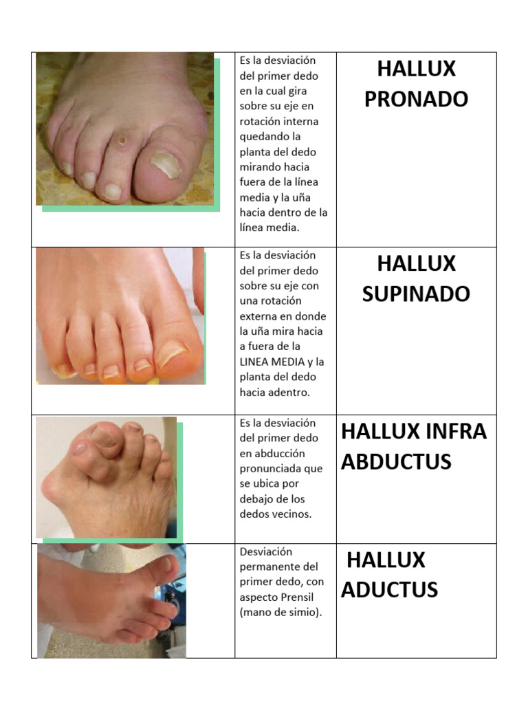 Actividad Final | PDF | Clavo (anatomía) | Dedo del pie