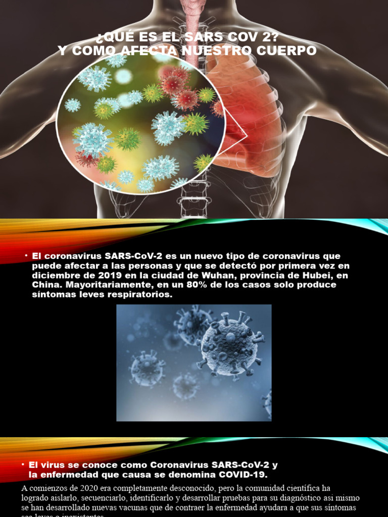 Qué Es El Sars Cov 2 | PDF | Virus | Biología