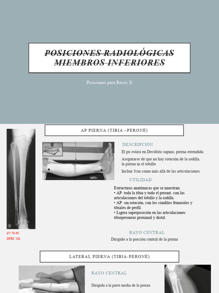 Posiciones Radiológicas- ROTULA | PDF | Rodilla | Tobillo