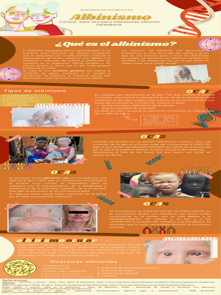 Albinismo | PDF | Color de piel humana | Enfermedades y trastornos