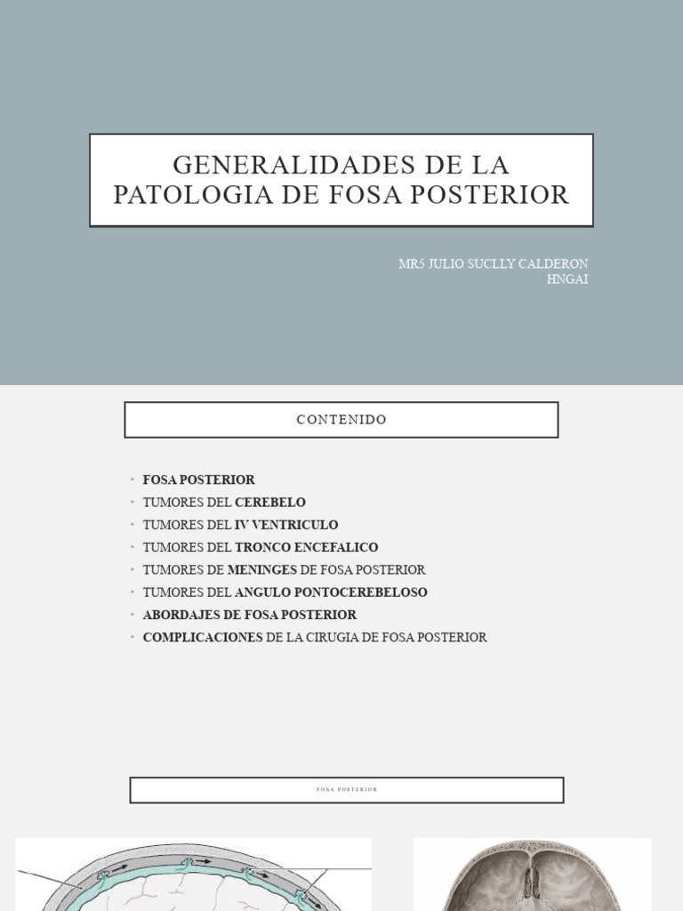 Patologia de Fosa Posterior | PDF | Especialidades Medicas | Tumor cerebral