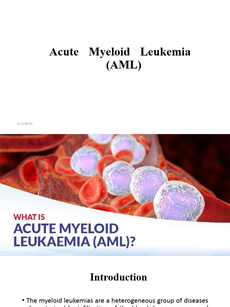 Acute Myeloid Leukemia (AML) | PDF | Leukemia | Haematopoiesis