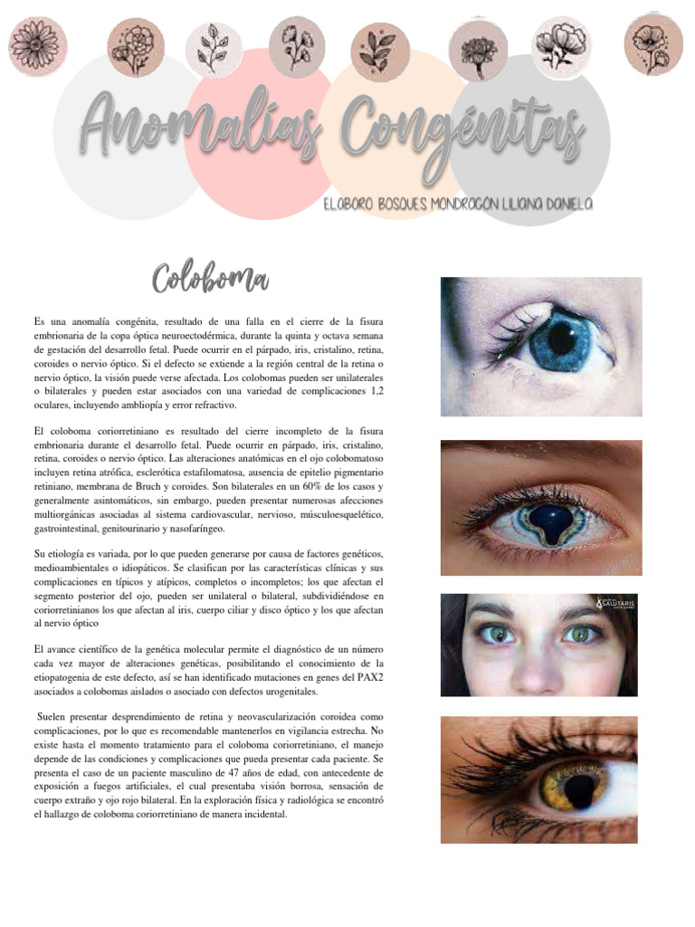 Anomalías Oculares Congénitas: Coloboma y Microftalmía | PDF | Ojo ...