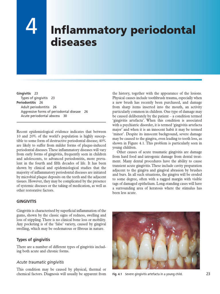 4.inflammatory Periodontal Diseases | PDF | Periodontology | Inflammation