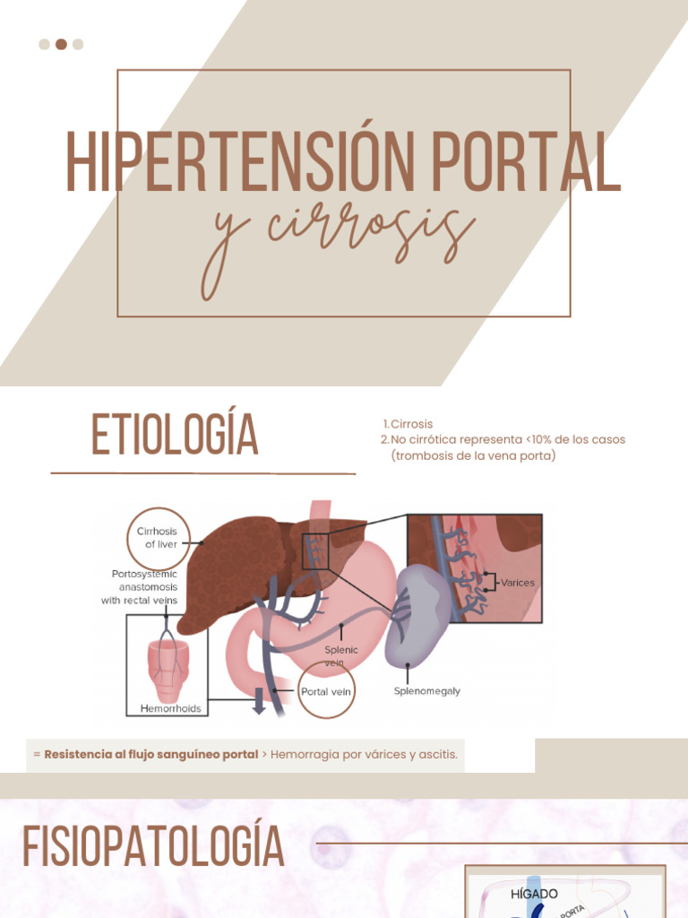 Hipertensión Portal | PDF | Cirrosis | Especialidades Medicas
