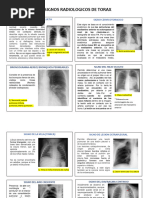 Manual de Signos Radiológicos | PDF | Pulmón | Anatomía