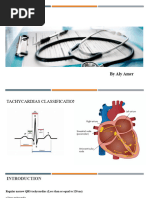 Atrial Fibrillation:Flutter in Pre-Excitation - LITFL - ECG Library ...