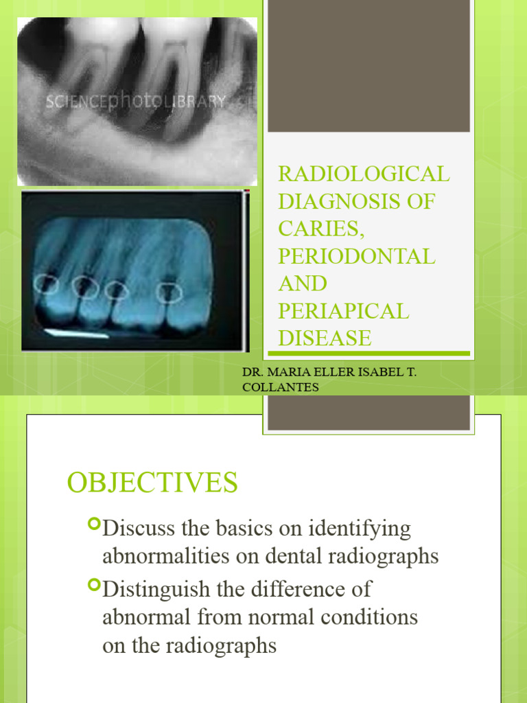 RADIOLOGICAL DIAGNOSIS OF CARIES PERIODONTAL AND PERIAPICAL Final 2 ... RADIOLOGICAL DIAGNOSIS OF CARIES PERIODONTAL AND PERIAPICAL Final 2 ...