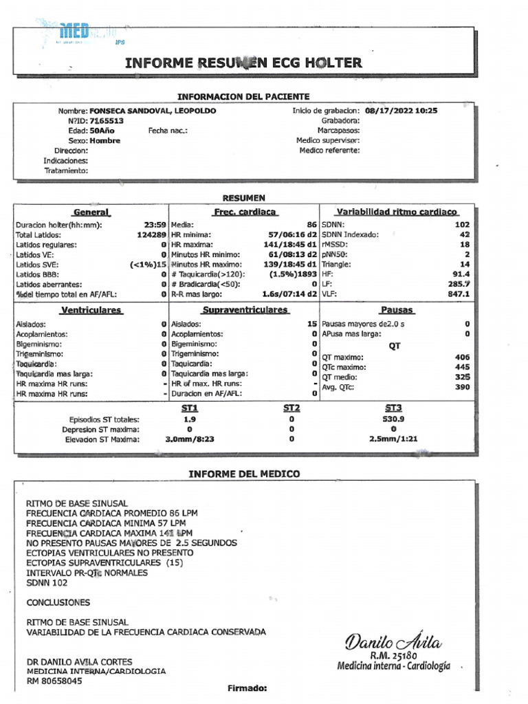 Informe Resumen ECG HOLTER | PDF