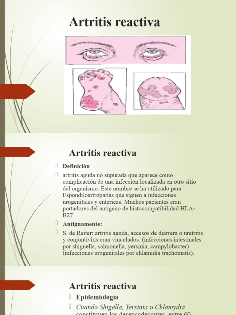 Artritis Reactiva, Psoriasica y Enteropatica | Descargar gratis PDF | Artritis Reumatoide ...