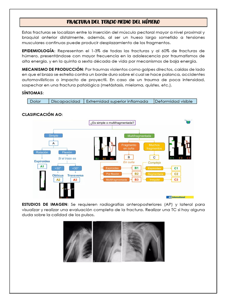 Fractura Del Tercio Medio Del Húmero | PDF | Enfermedades y trastornos ...