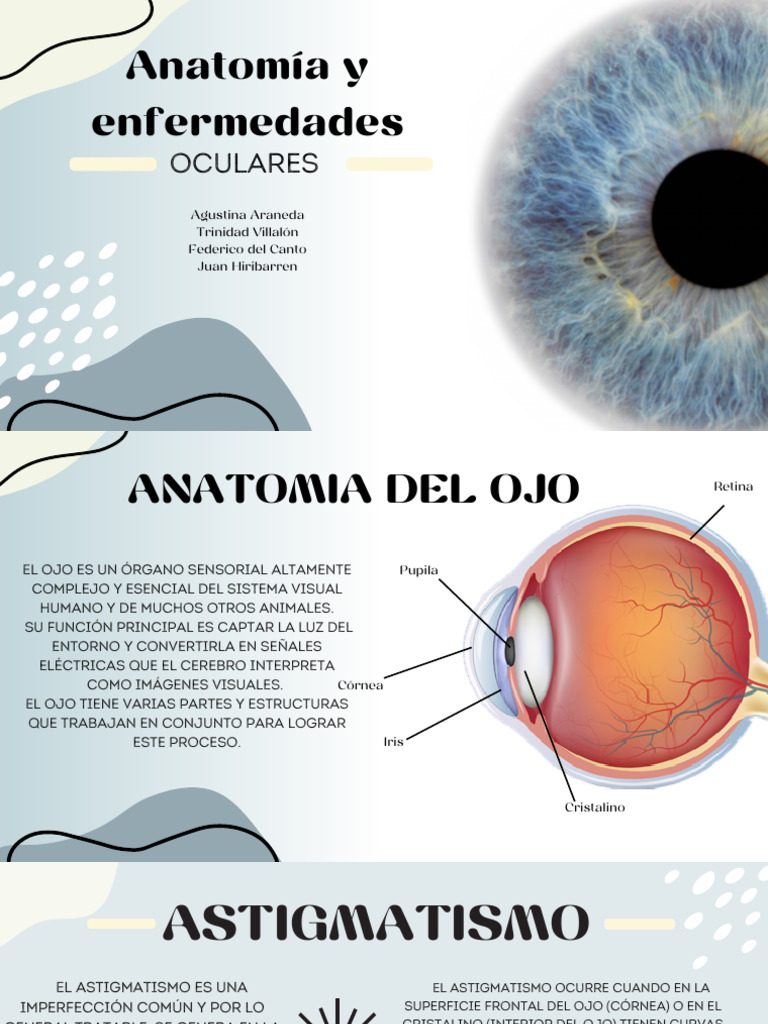 Enfermedades | PDF | Ojo humano | Miopía