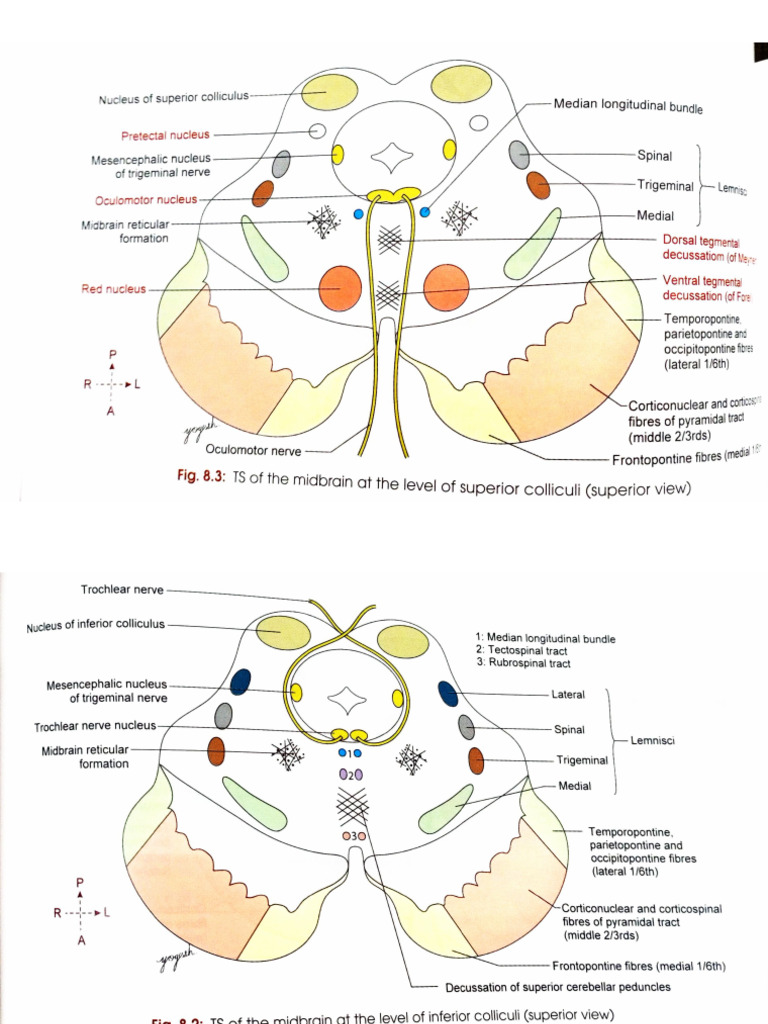 TS Medulla, Pons & Midbrain | PDF