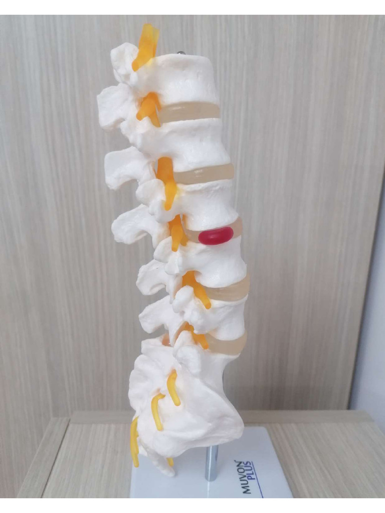 Coloana lombara 2 | PDF