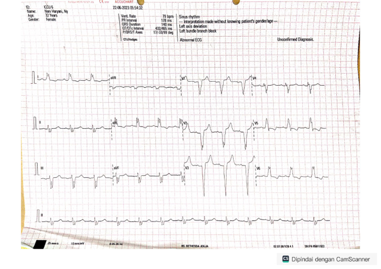 ECG Bu Nani TGL 22 Juni | PDF