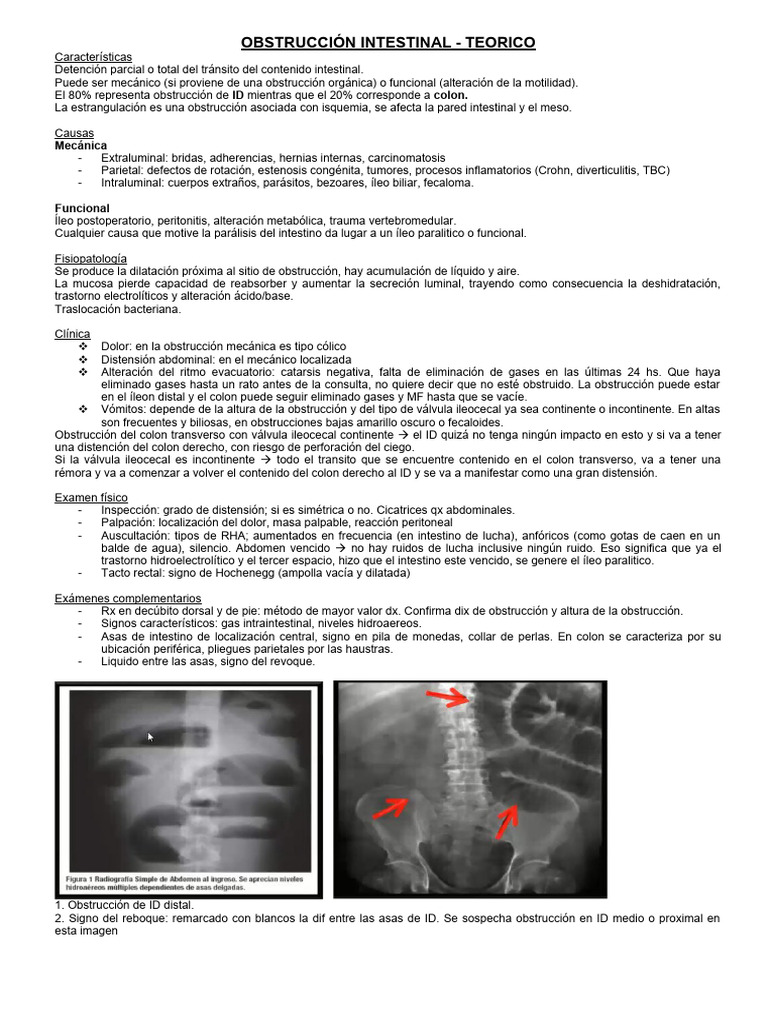 Obstrucción Intestinal: Causas y Tratamiento | PDF | Intestino grueso ...