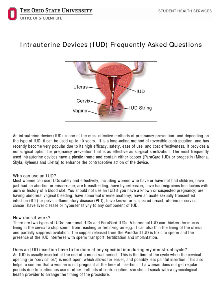 IUD FAQs: Usage, Benefits, and Care | PDF | Birth Control | Clinical ...