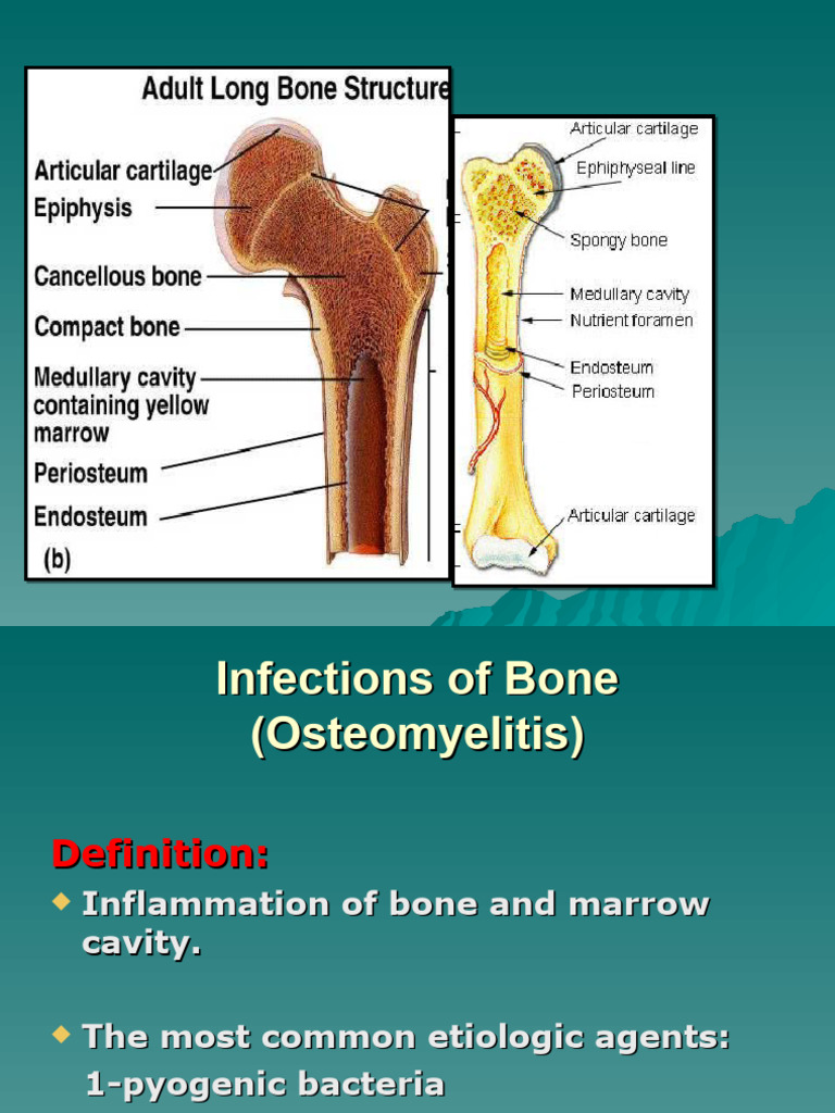 Bone Infections For PM | PDF | Vertebral Column | Bone