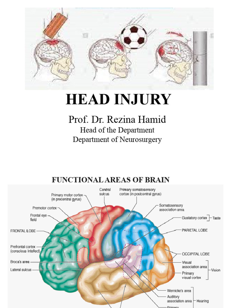 3lecture Rose-Head Injury | PDF | Traumatic Brain Injury | Causes Of Death