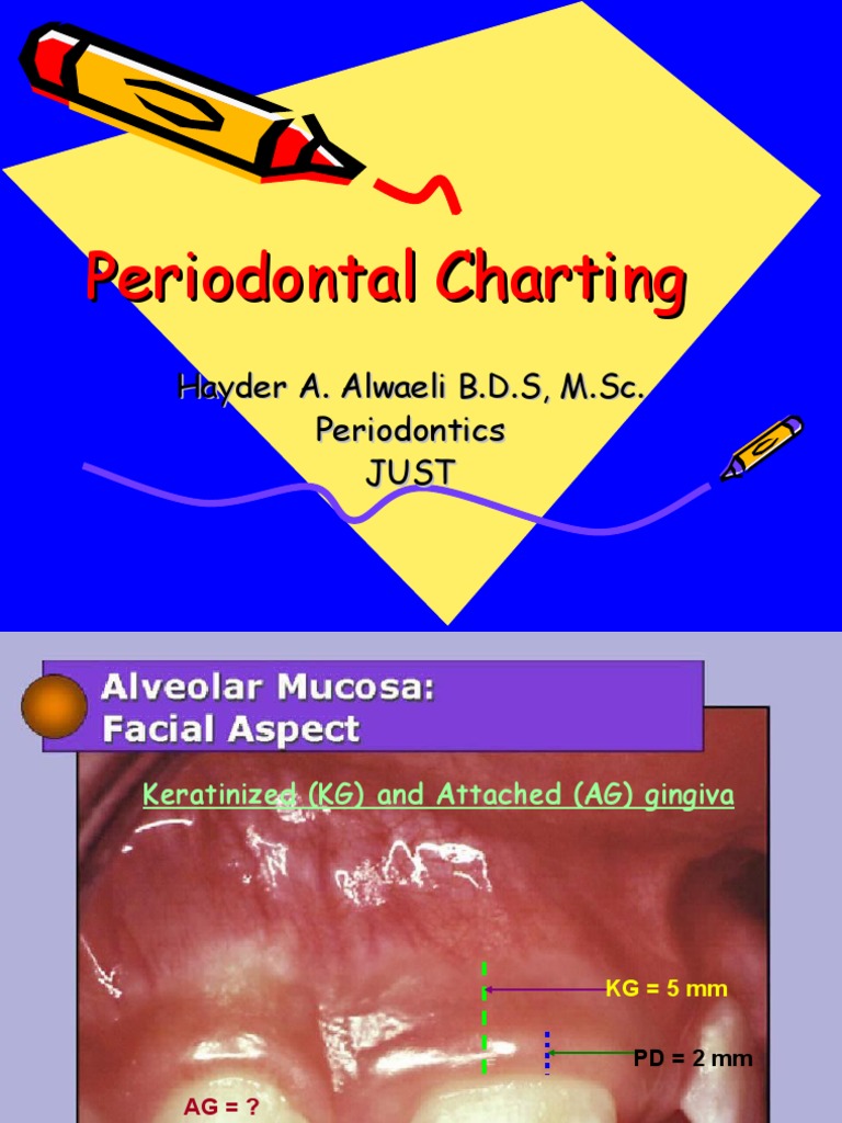Periodontal Charting Techniques | PDF