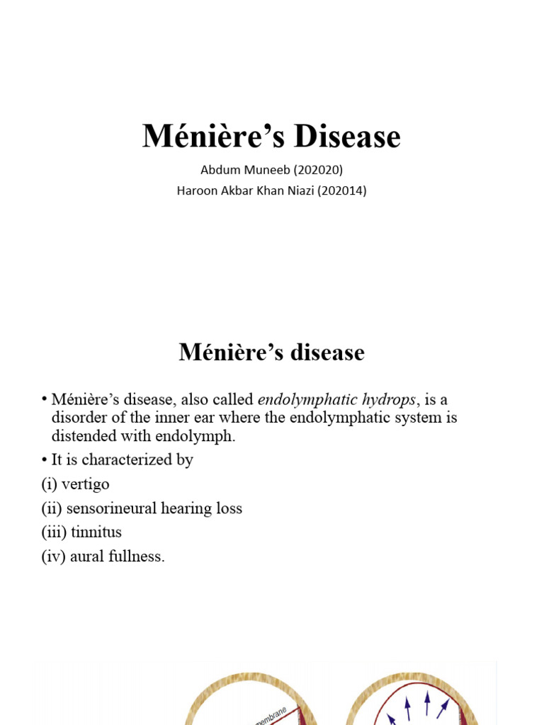 Ménière's Disease | PDF | Vertigo | Ménière's Disease