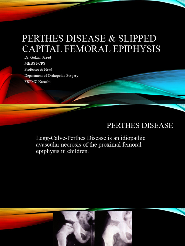 Perthes Ds SUFI | PDF | Clinical Medicine | Musculoskeletal System