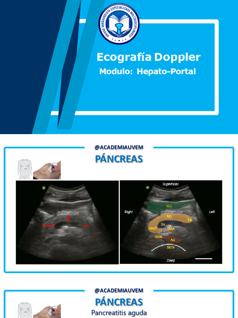 Doppler Hepato Portal | PDF | Hígado | Sistema digestivo