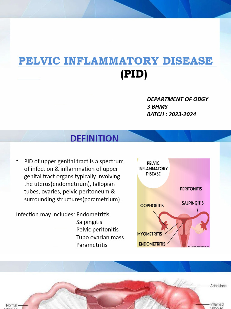 PID OBGY | PDF | Medical Specialties | Diseases And Disorders