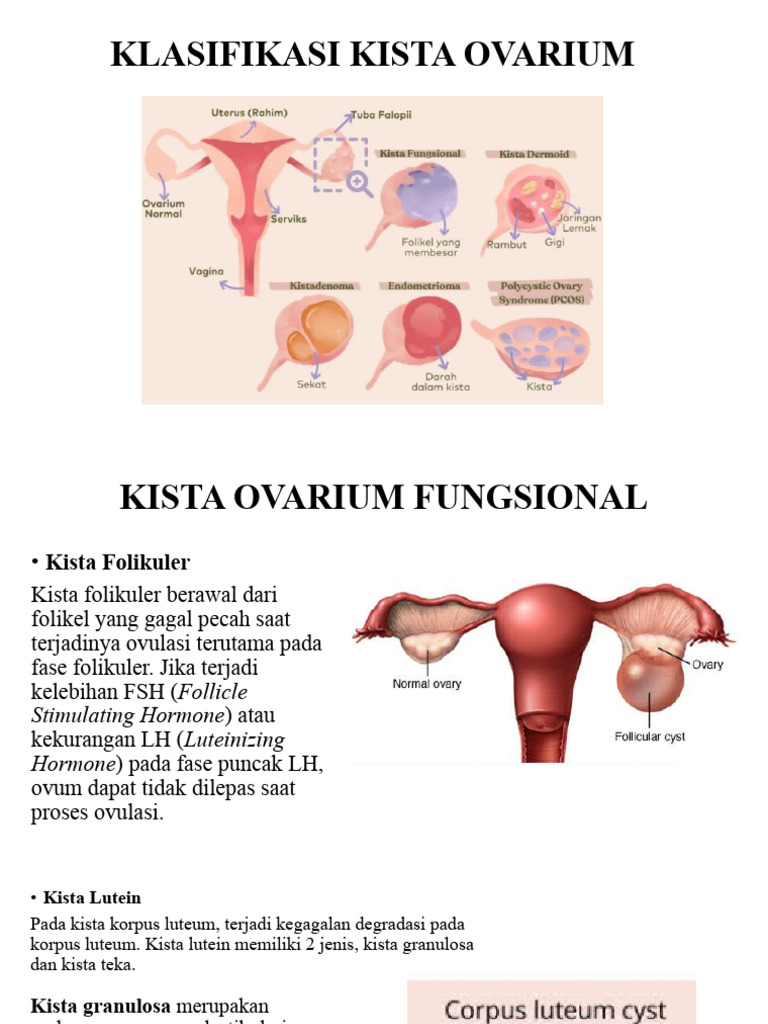KLASIFIKASI Dan FAKTOR RESIKO KISTA OVARIUM | PDF