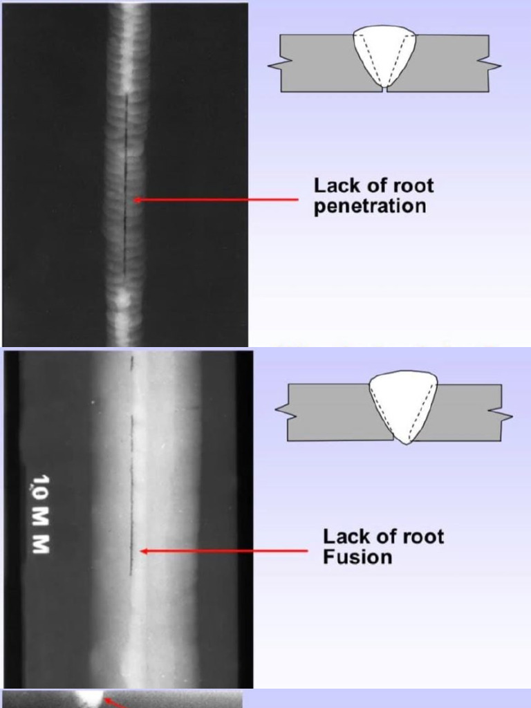Radiography Interpretation | PDF