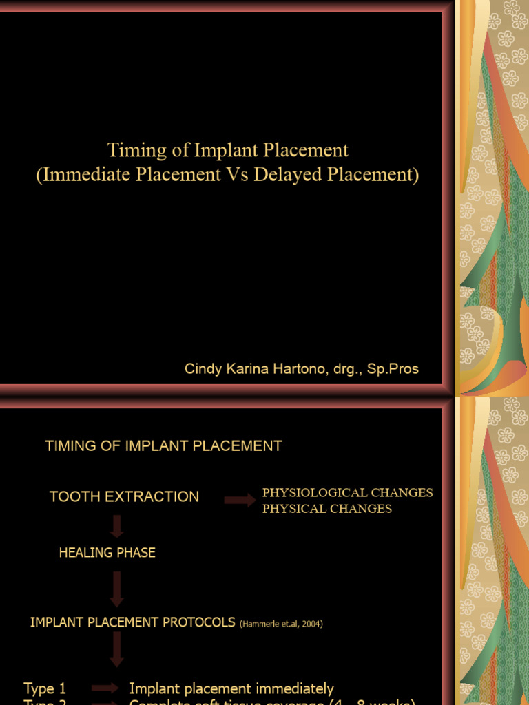 Timing of Implant Placement | PDF | Dental Implant | Healing