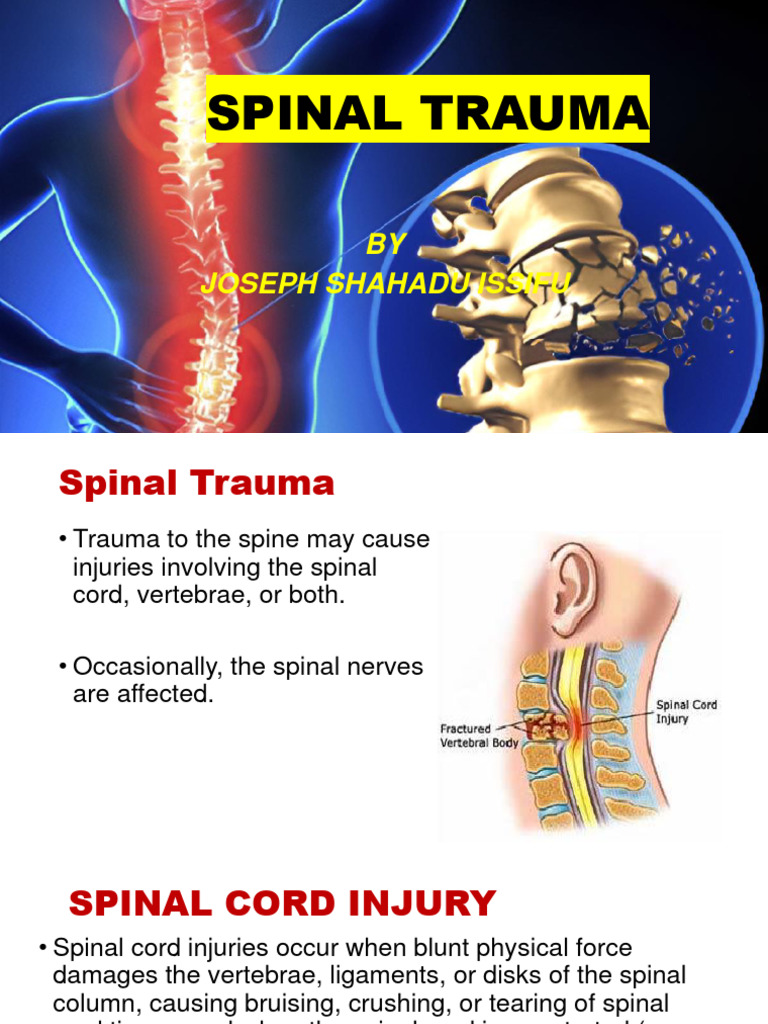 SPINAL TRAUMA | PDF | Vertebral Column | Spinal Cord Injury