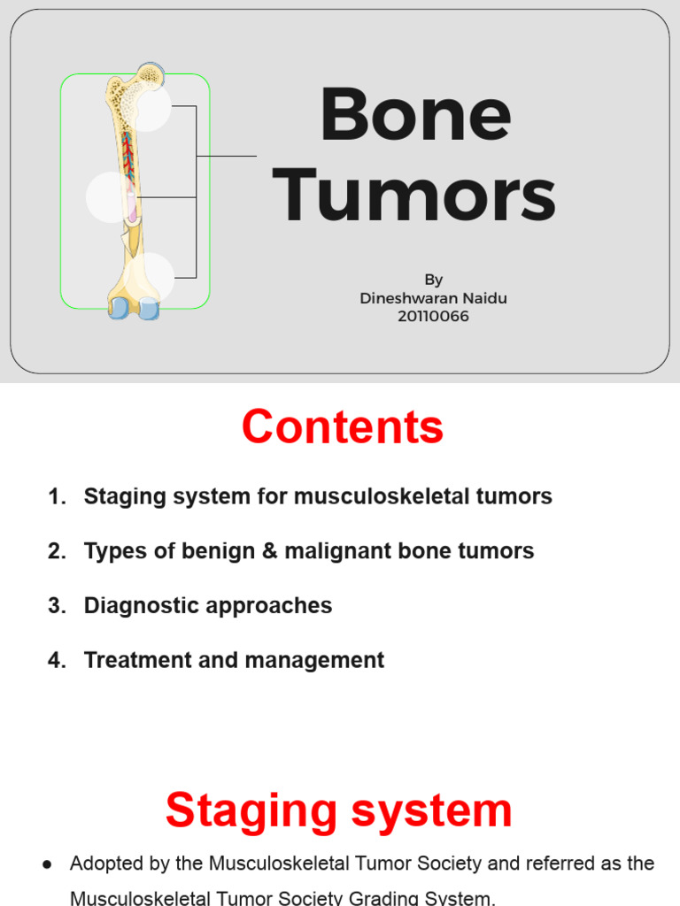 Bone Tumors | PDF | Bone | Sarcoma