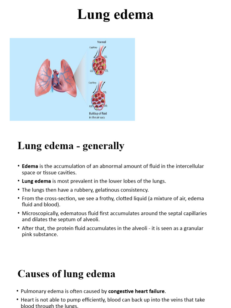 Causes and Types of Lung Edema | PDF