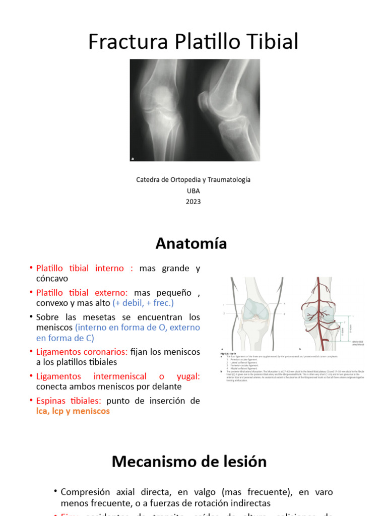 FX de Platillo Tibial | PDF | Rodilla | Sistema musculoesquelético