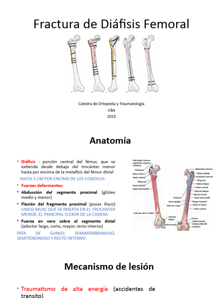 FX de Diafisis Femoral | PDF | Rodilla | Sistema musculoesquelético