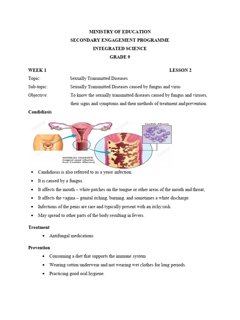 Grade 9 Integrated Science Week 1 Lesson 2 | PDF | Candidiasis | Hiv/Aids