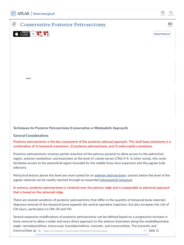 Posterior Petrosectomy - The Neurosurgical Atlas | PDF | Brainstem | Skull