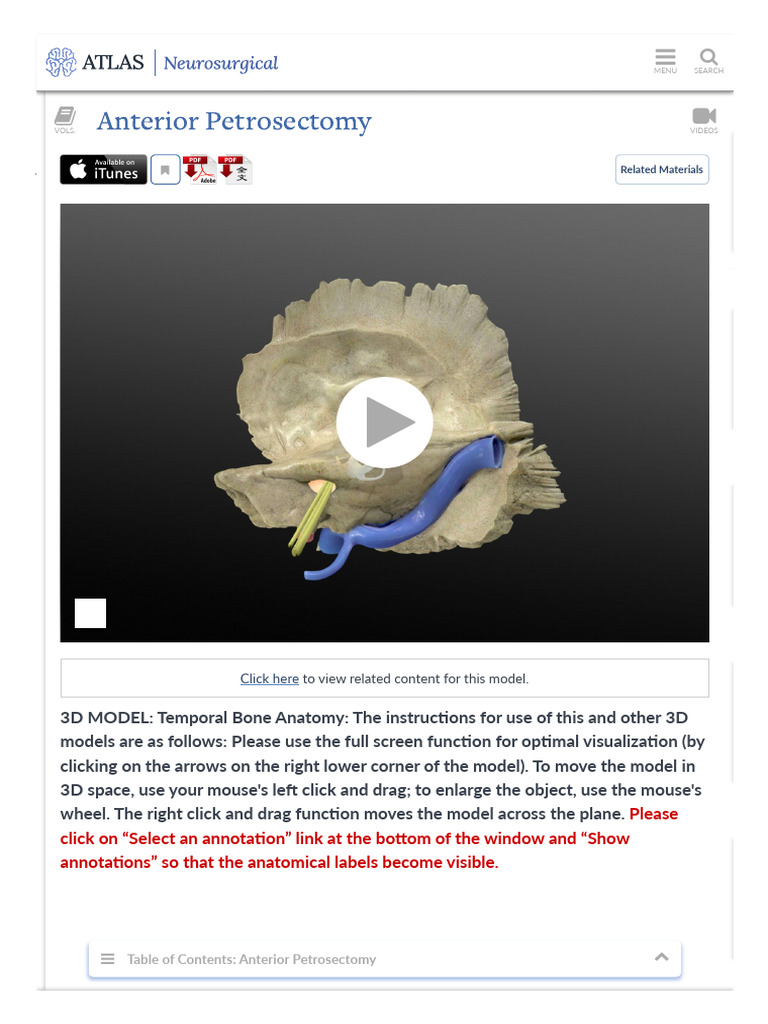 Anterior Petrosectomy - The Neurosurgical Atlas | PDF | Anatomy | Human ...