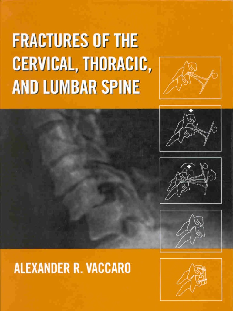 Fracturi de Coloana Cervicala, Toracala Si Lombara | PDF | Vertebra ...