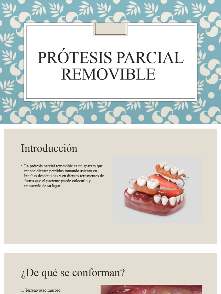 Prótesis Parcial Removible | PDF | Odontología | Boca