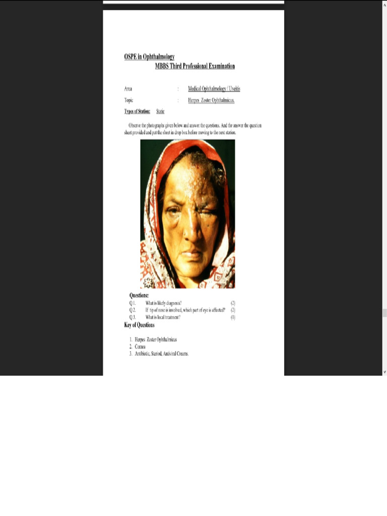 OSPE MBBS Aymon Blog 3 | PDF