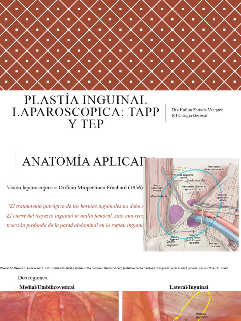 Iguinal Hernia Laparos | PDF
