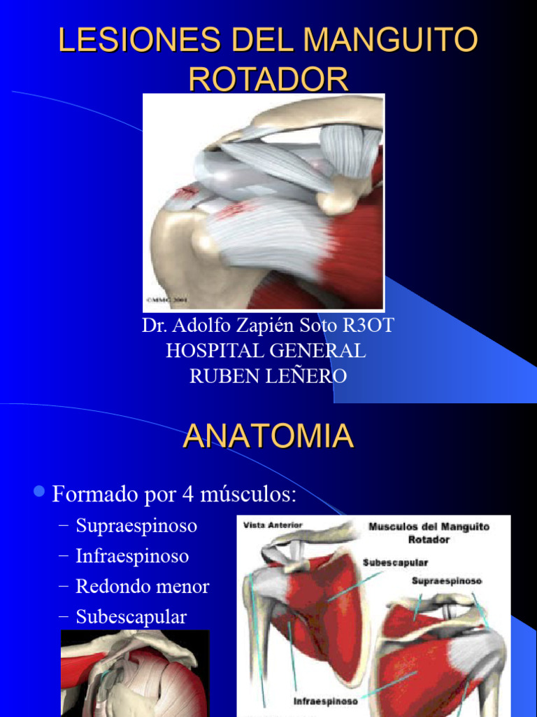 Lesiones del Manguito Rotador: Guía Completa | PDF | Hombro ...