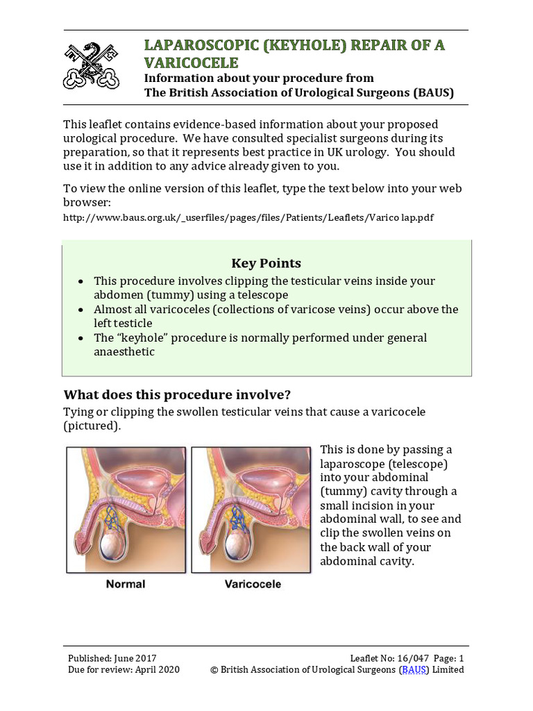 Varicocele Surgery Overview and Care | PDF | Surgery | Urology