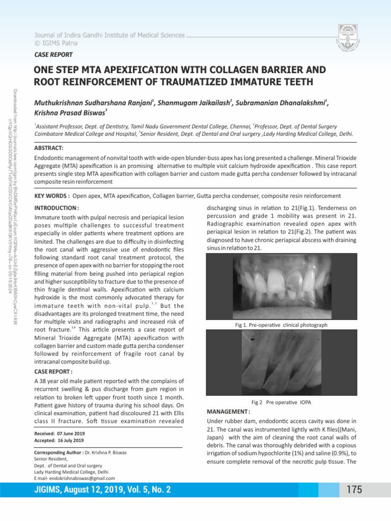 One Step Mta Apexification With Collagen Barrier.16 | PDF | Tooth ...