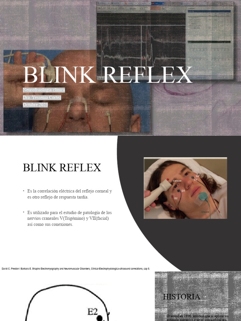 Blink Reflex | Descargar gratis PDF | Sistema nervioso | Neurociencia