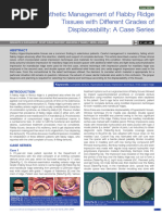 Spoon Dentures: Design and Uses | PDF