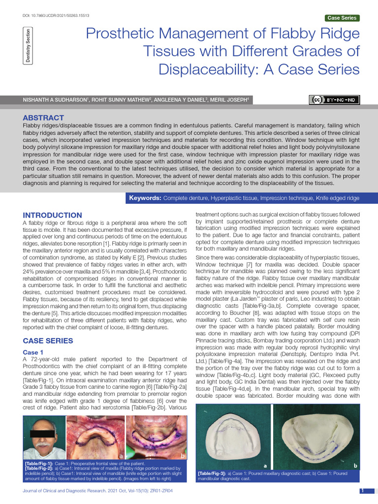 Prosthetic Management of Flabby Ridge Tissues With Different Grades of ...