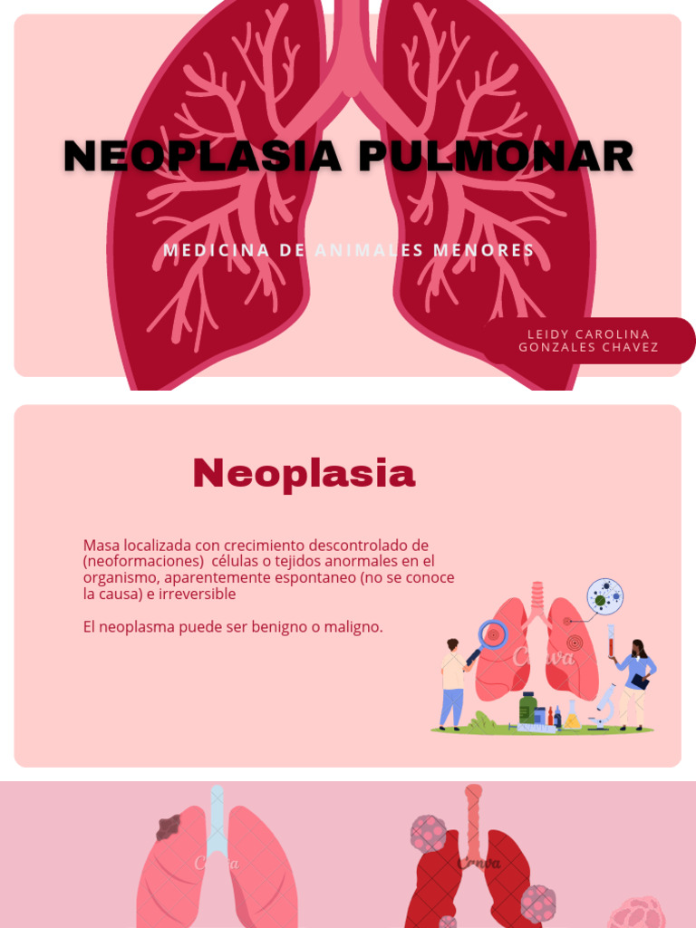 Neoplasia Pulmonar | PDF | Cáncer de pulmón | Cáncer